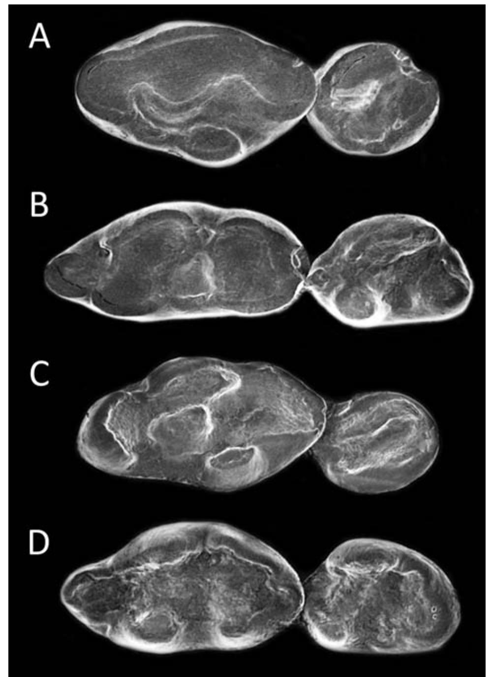 —occlusal views of the left maxillary and right mandibular