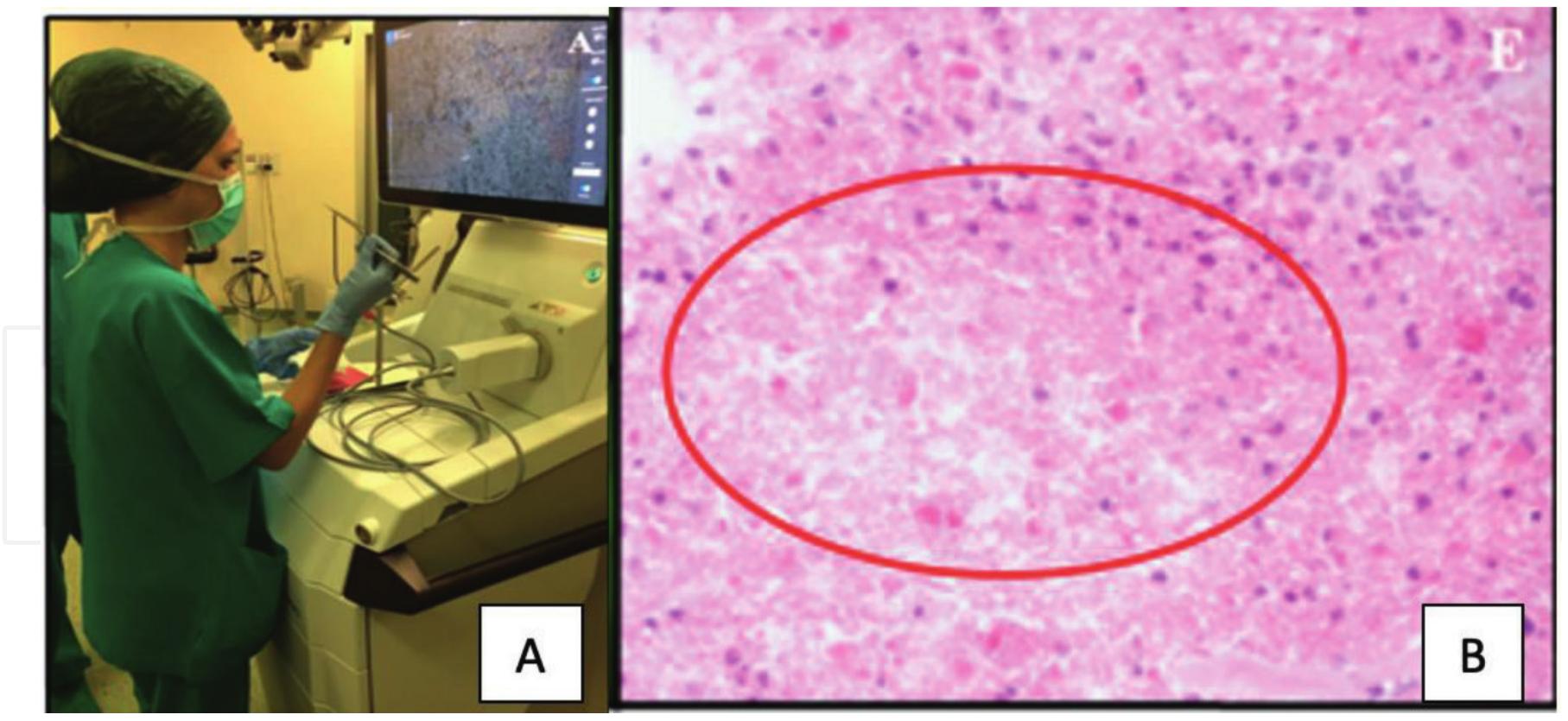 (PDF) Introduction of Histopathology