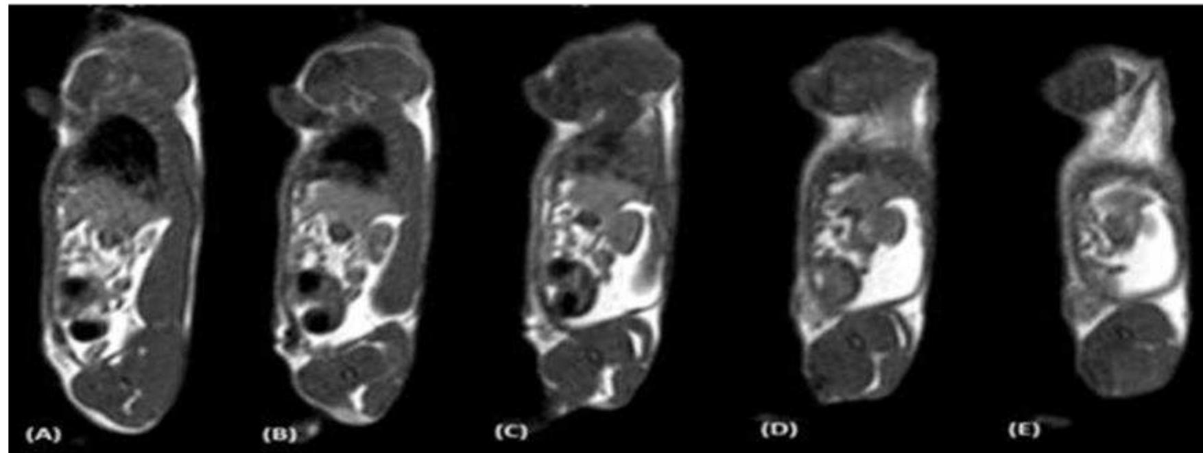 T1 shows the images from the b3 sample mri that show clarity