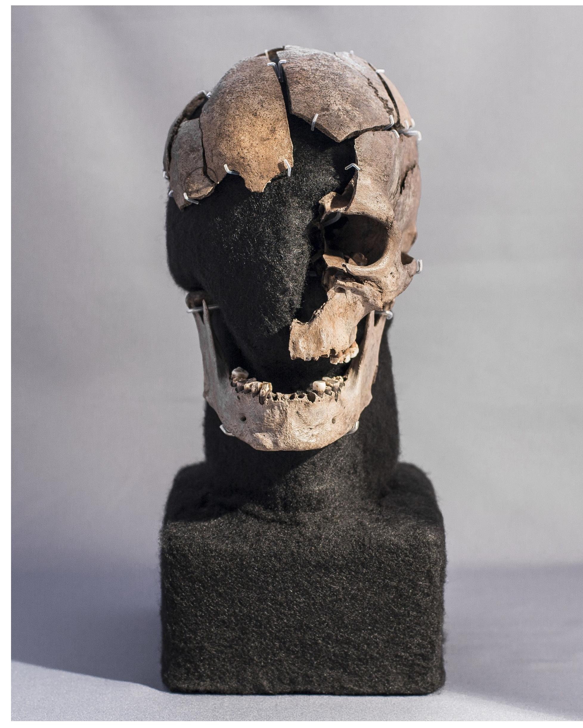 The cranial remains of vittrup man, who ended up in a bog