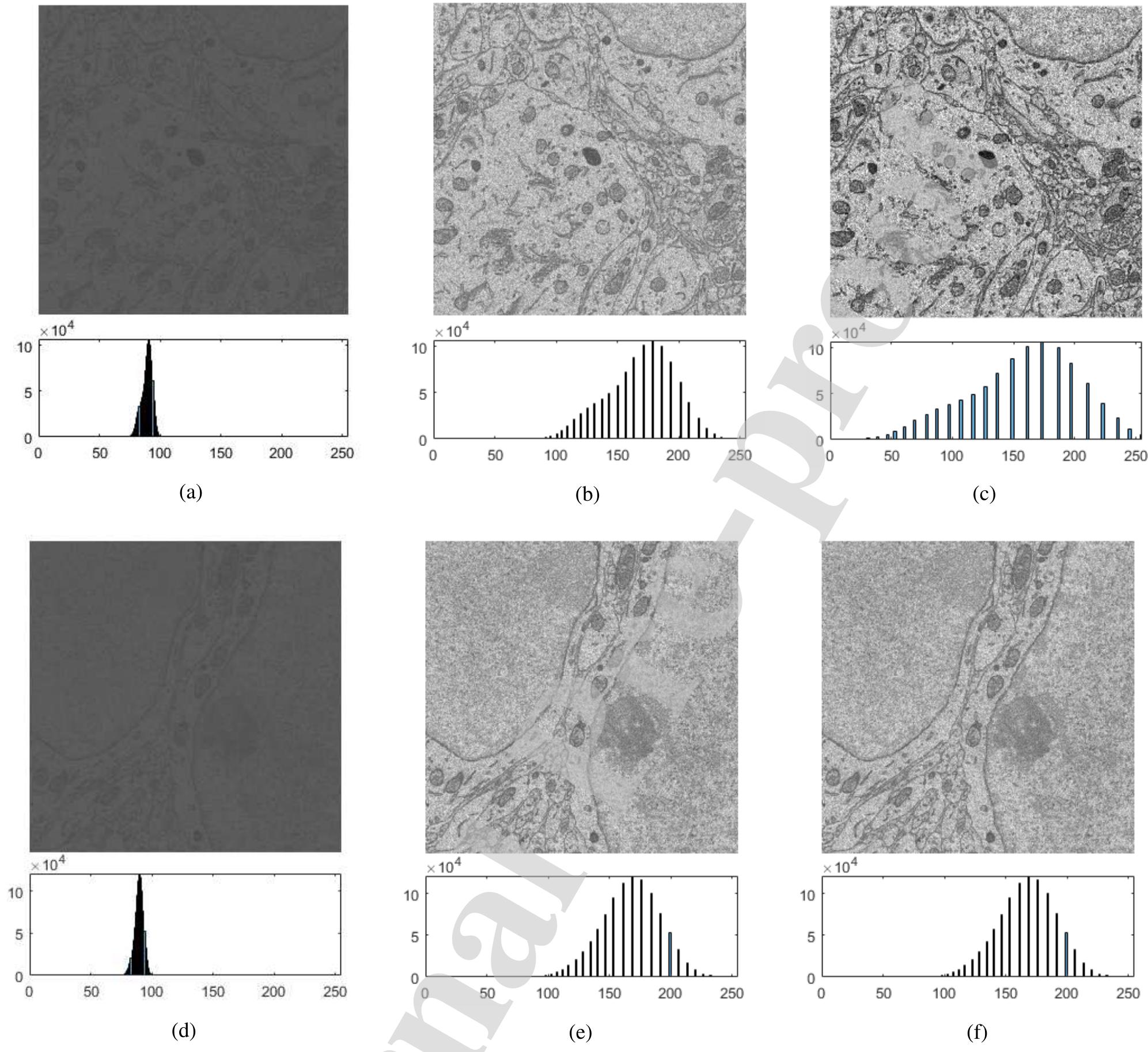 Examples of contrast enhanced images. (a) and (d) are the