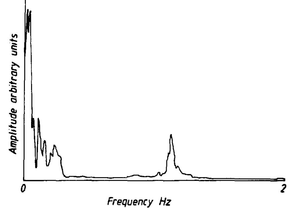 Frequency spectrum of photoplethysmograph signal — subject