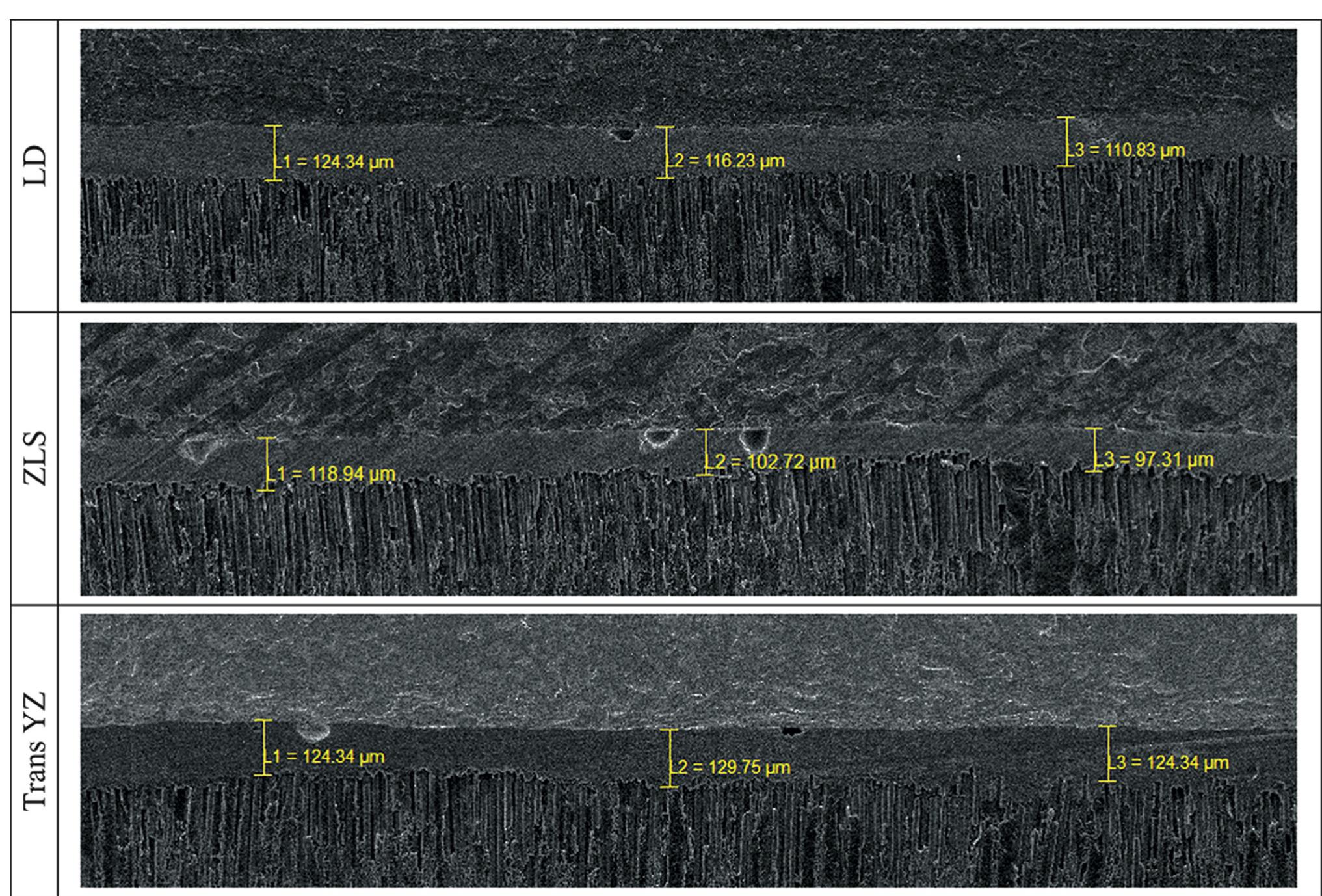 Scanning electron microscope images depicting luting agent