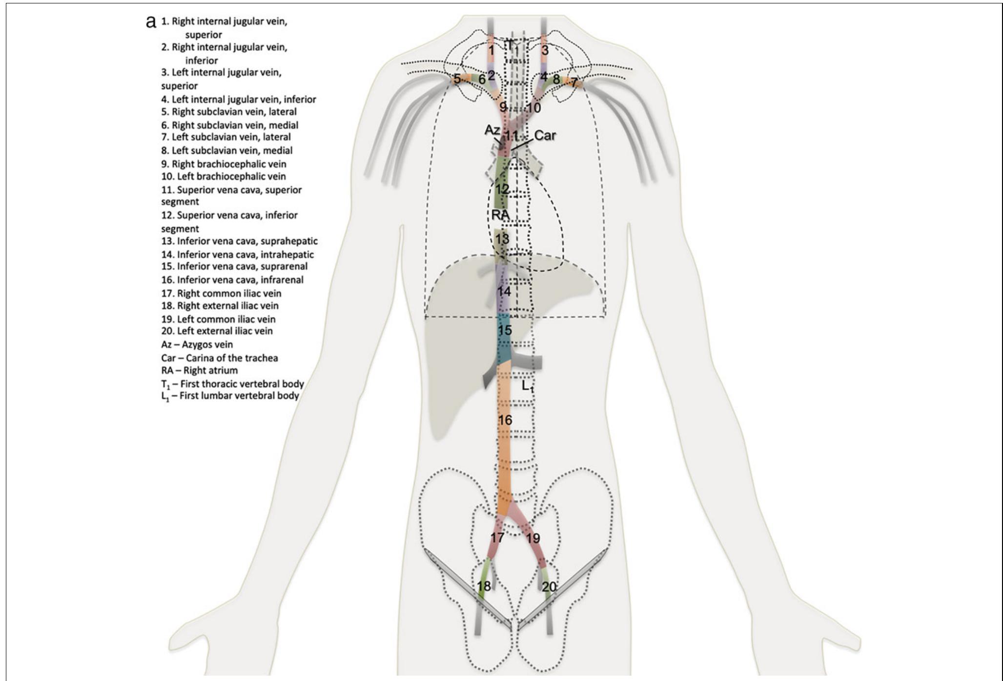 Al. (a) central venous anatomy. (b) upper extremity venous