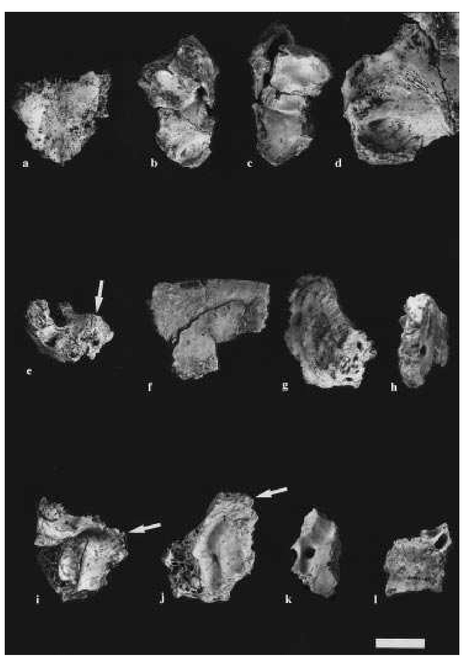 Occipital, sphenoid and temporal bones. (a) atd6-16, lateral