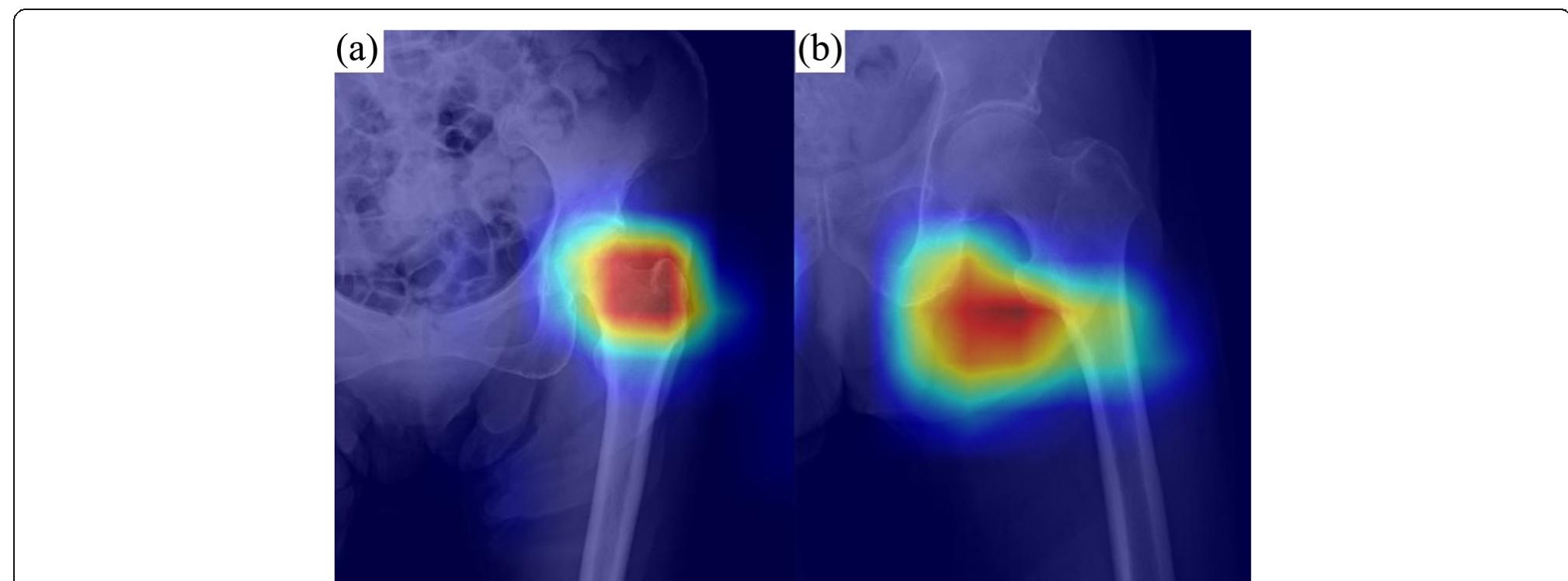Visualization of the area of fracture detection using