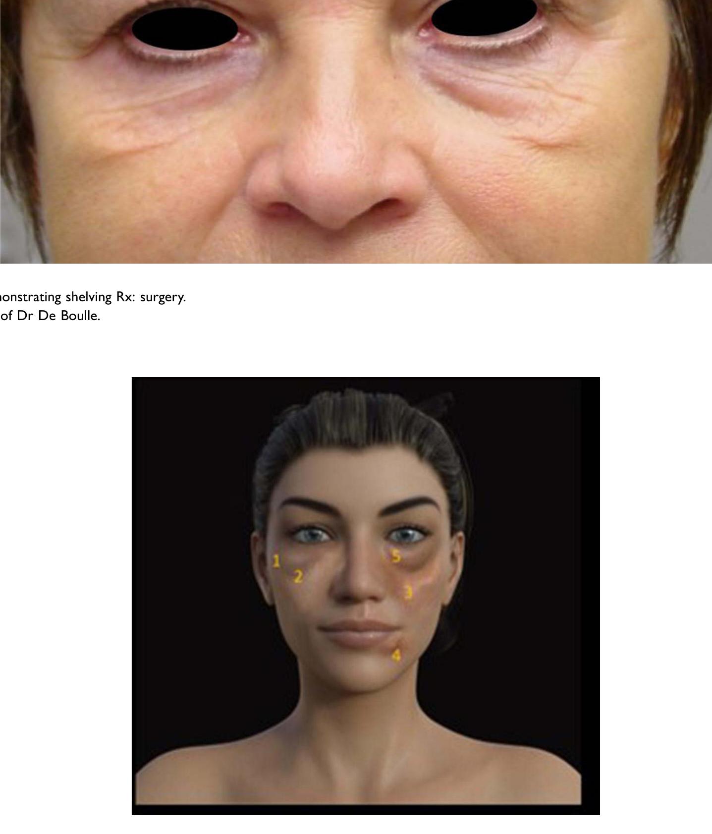 Differential diagnosis of swelling. | = edema; 2 = malar