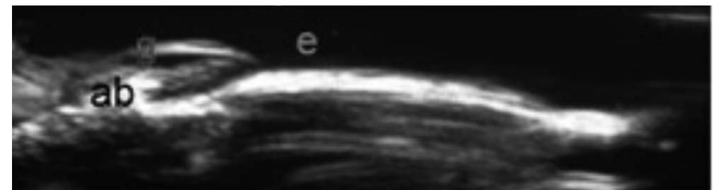 Buccolingual cross-section of the alveolar bone, gingiva,