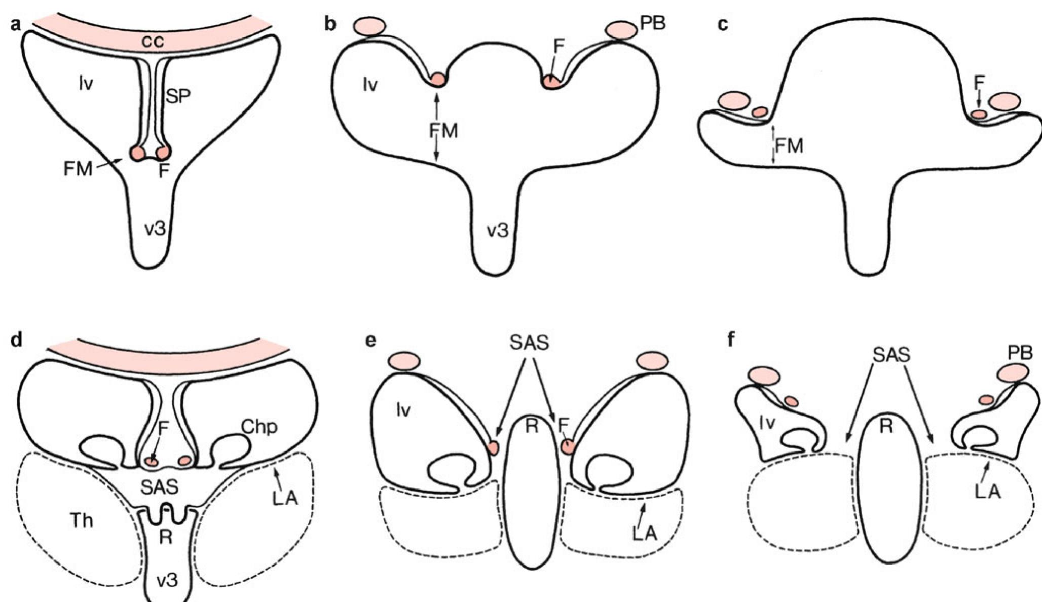 A septum pellucidum. cc corpus callosum, chp choroid plexus