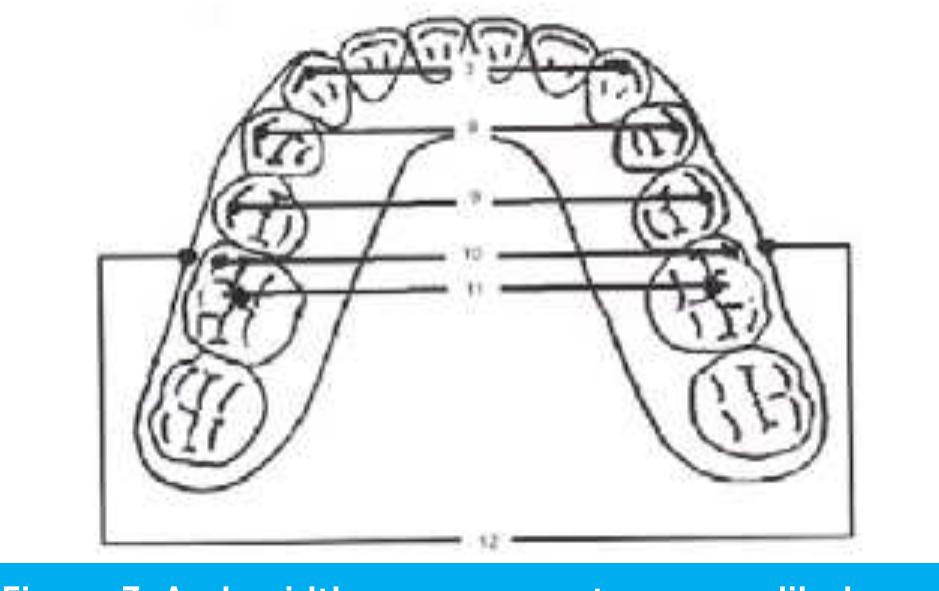 Cusp tips of maxillary right and left first molars. between