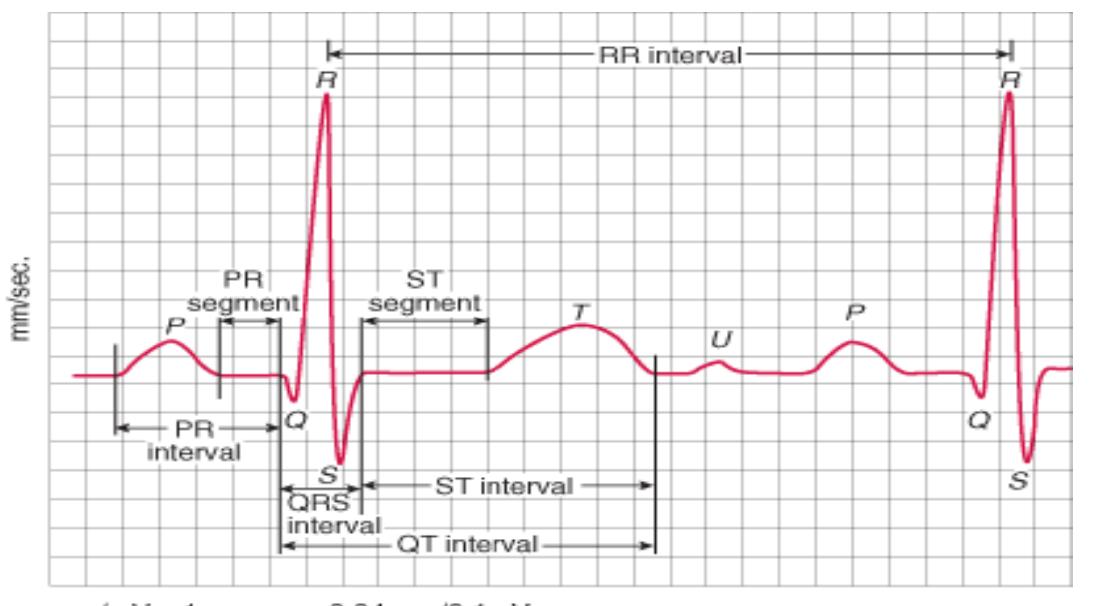the pqrst waveform of ecg signal[3] table 1: reference