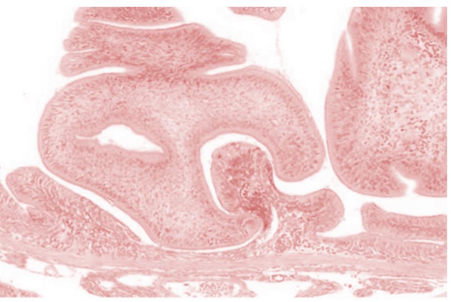 Figure 4 - Distribución y patología causada por