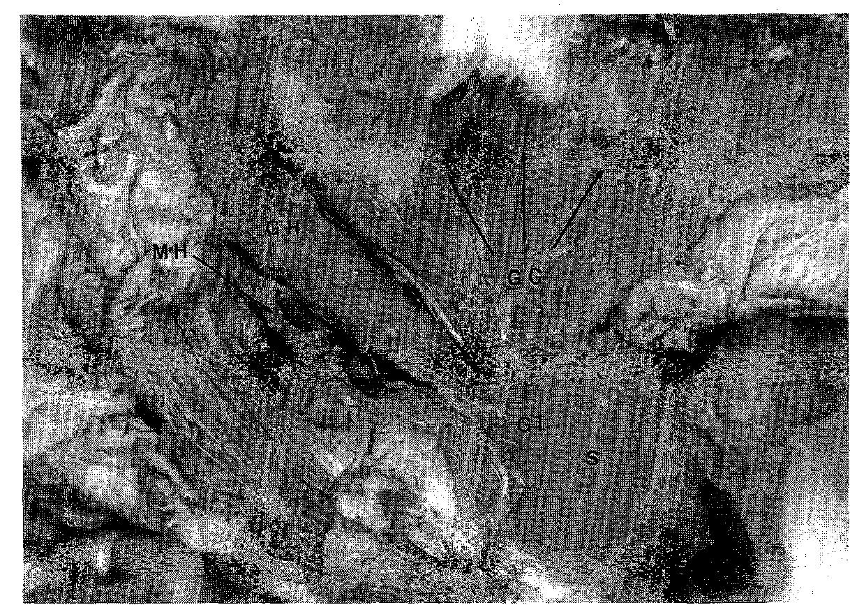 Sagittal view of mandible in cadaver shows symphysis (s),