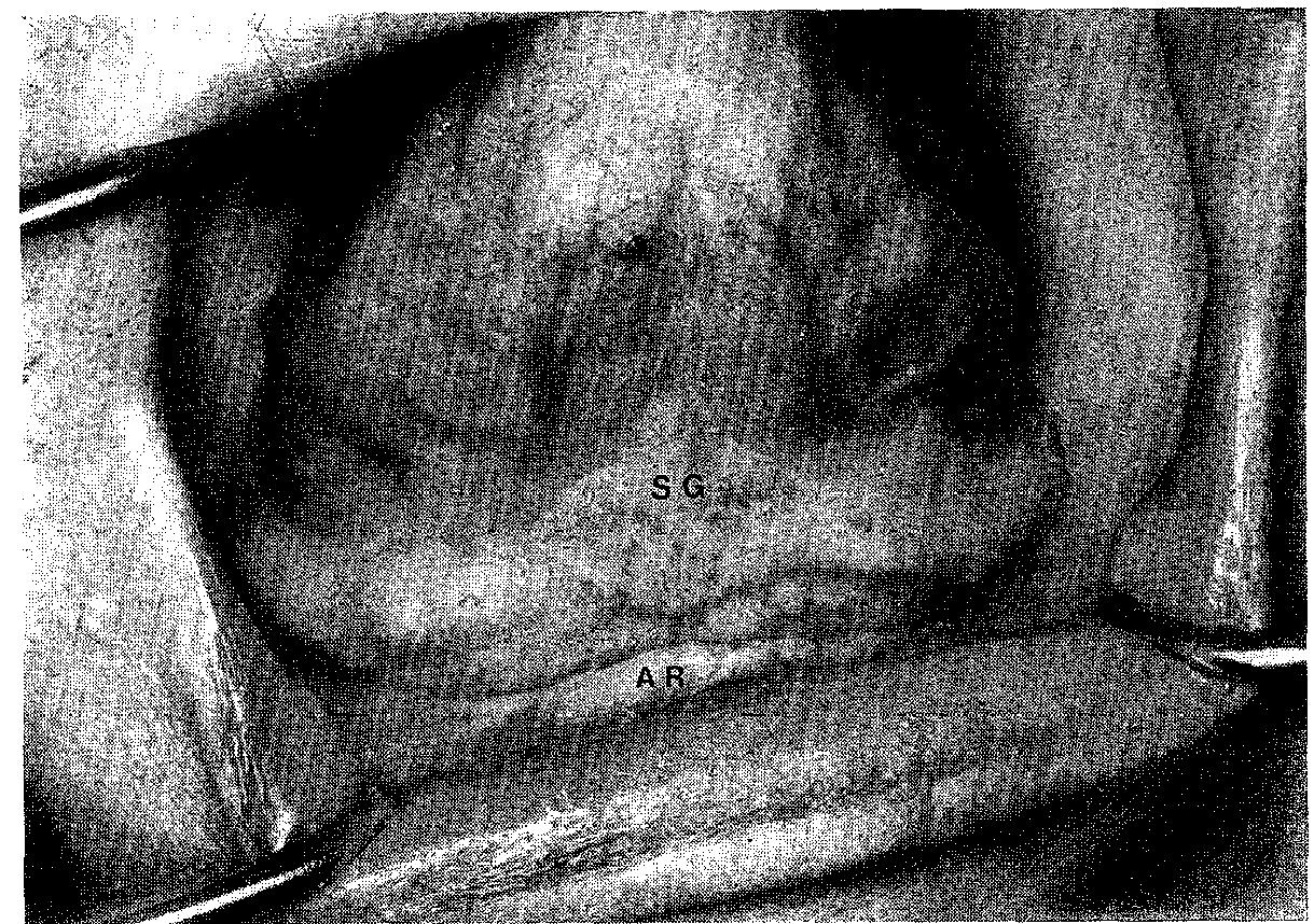 Whereas its posterior fibers originate from the alveolus at