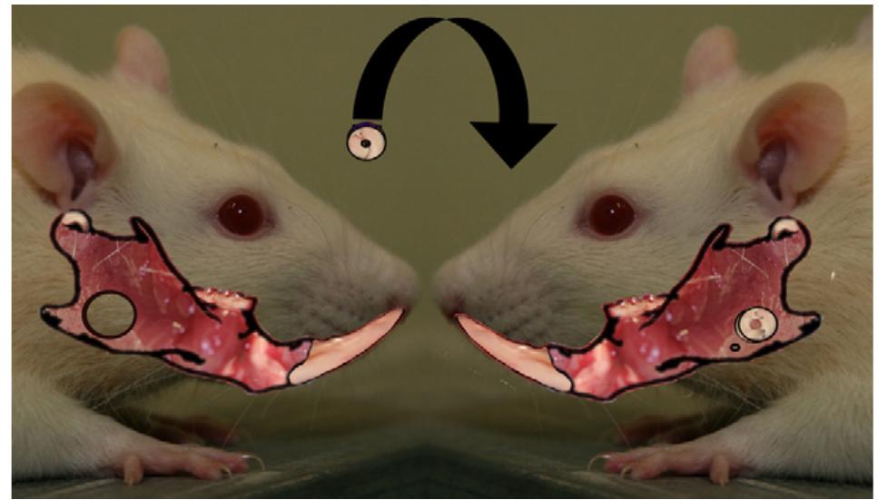 surgical procedure. in the right mandibular angle a