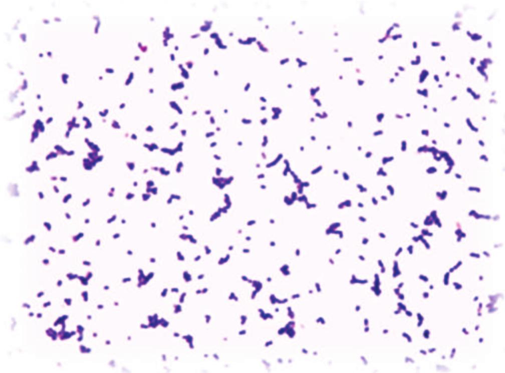 Gram staining shows characteristics of s. sanguinis’