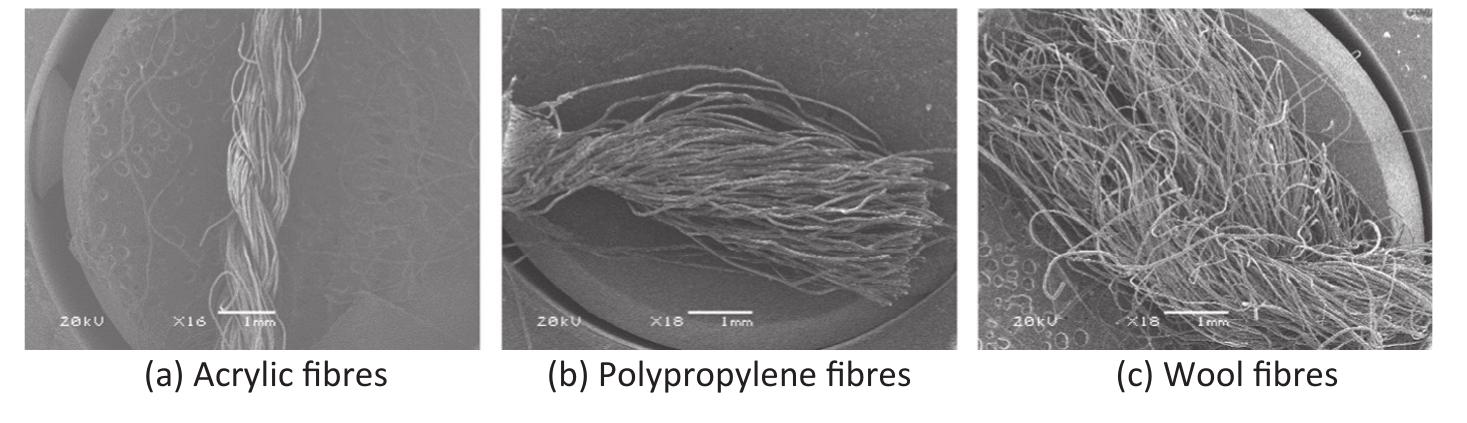 Tuft fibres as seen by the electron microscope. after a