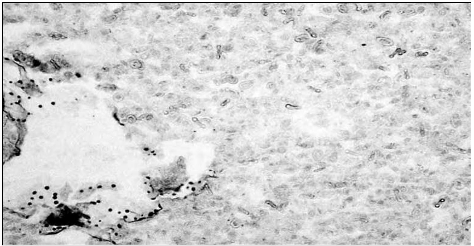 15—photomicrograph of the cross section of a philornid larva