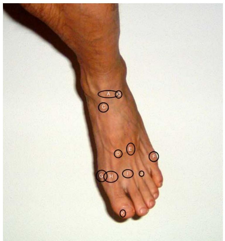Dorsal foot and ankle—typical locations of injury symptoms