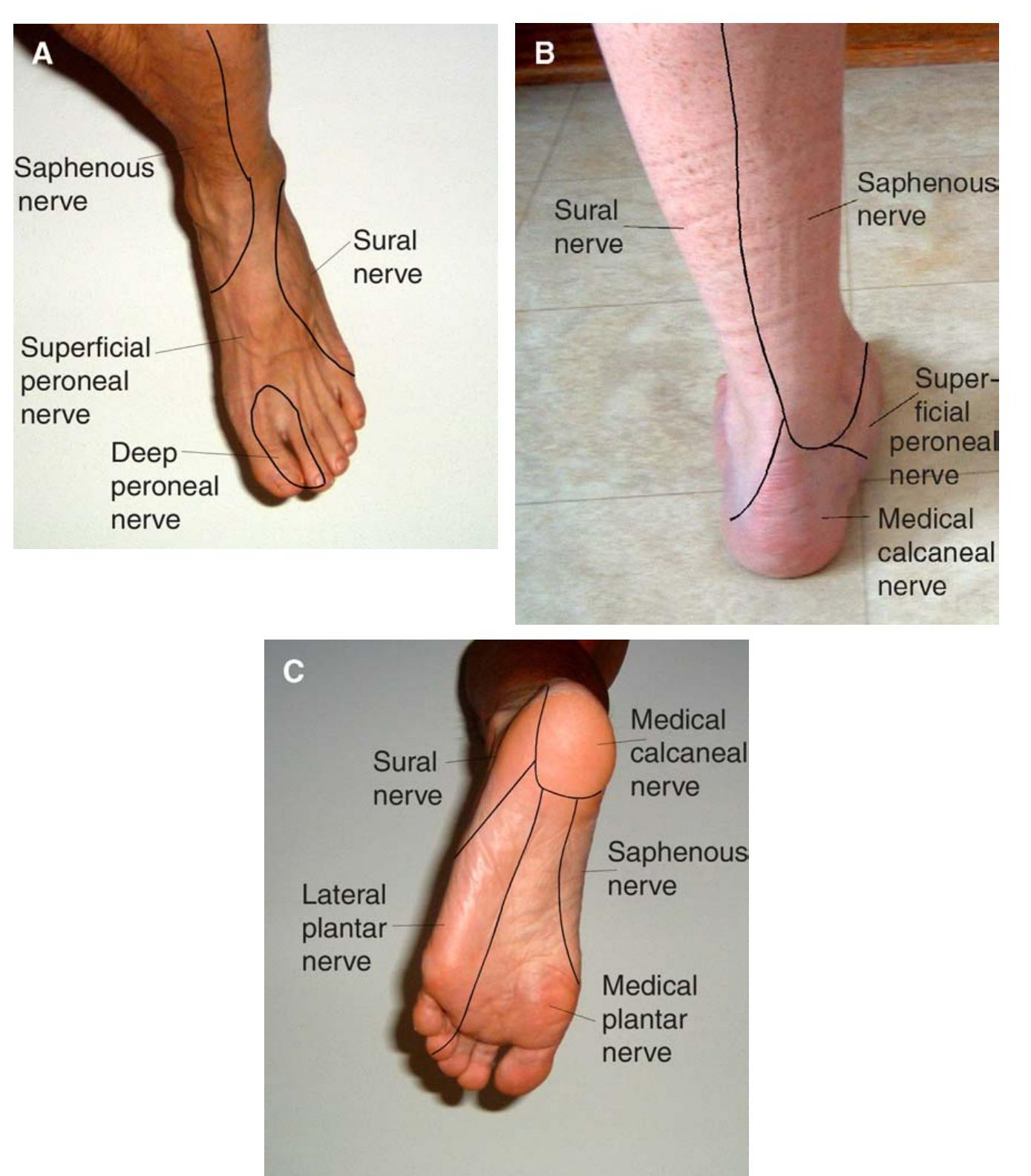 (a, b, c) typical sensory innervation of the foot and ankle.
