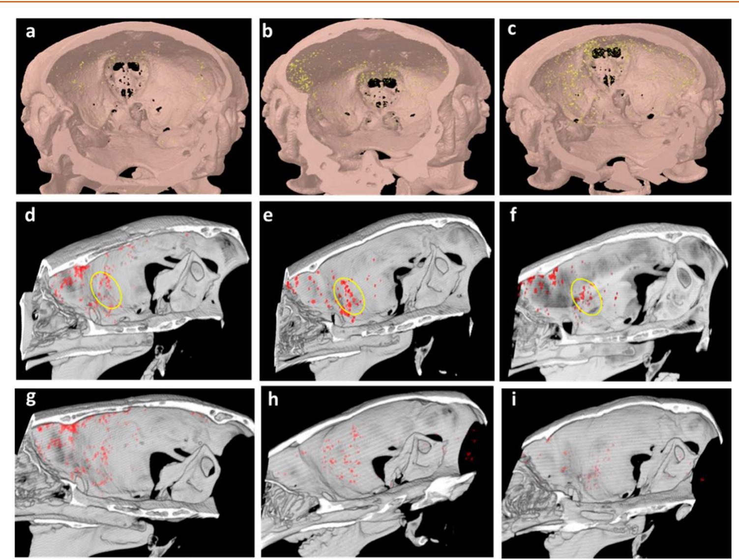 In vivo ct imaging of exosomes after acute striatal stroke