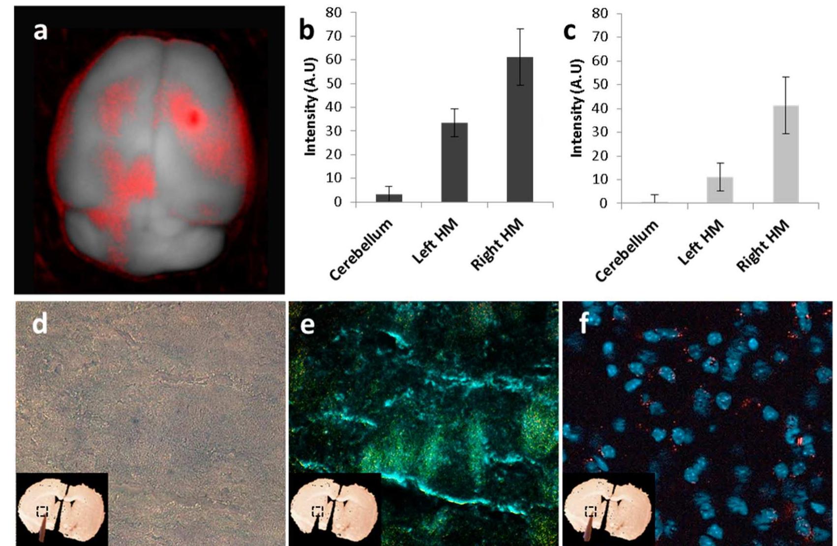 Imaging of double-labeled exosomes. (a) spectral unmixing