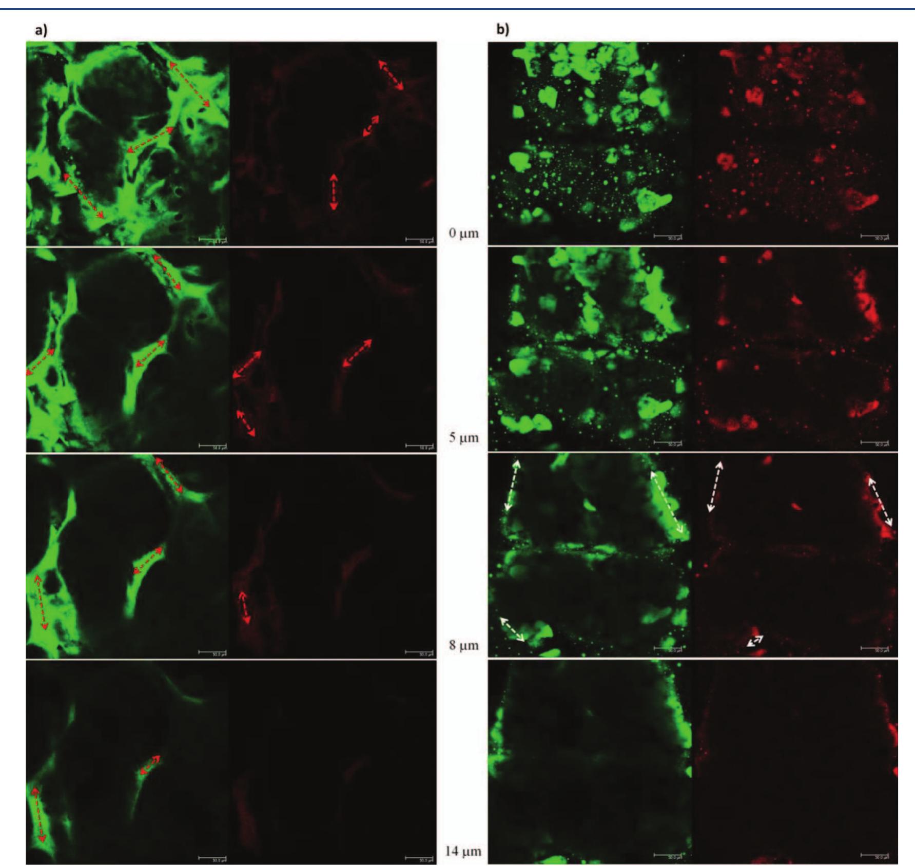 Topical skin cancer therapy using doxorubicin-loaded