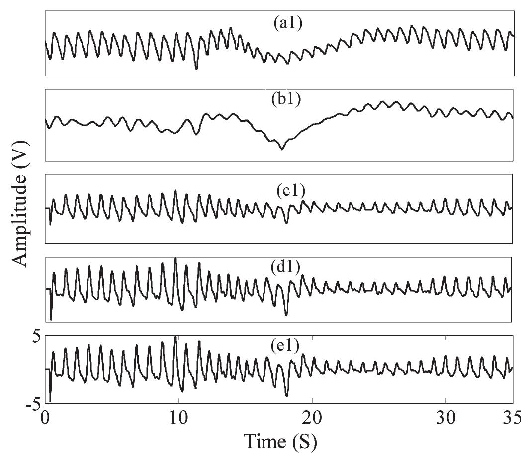 (PDF) A Novel Approach for Motion Artifact Reduction in PPG Signals ...