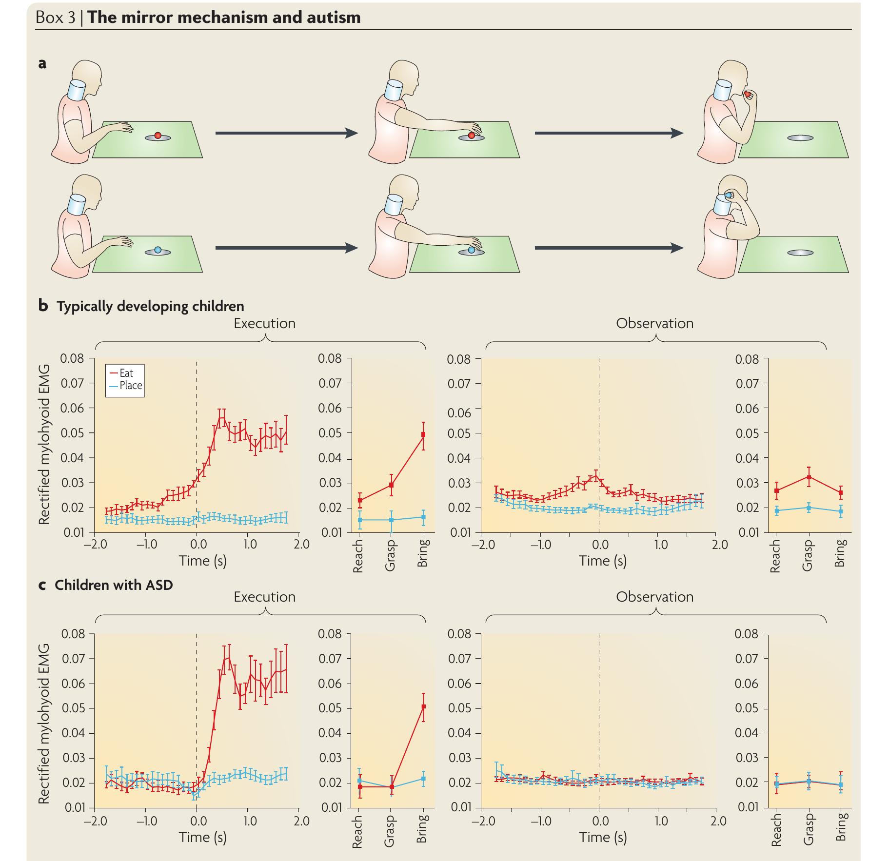 Autistic spectrum disorder (asd) is a syndrome characterized