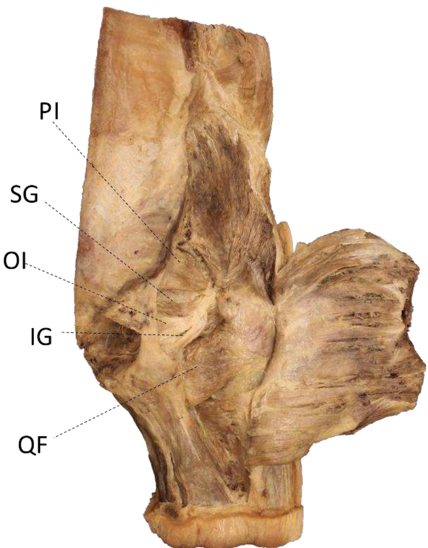 Posterior view of bisected pelvis, right side, with gluteus