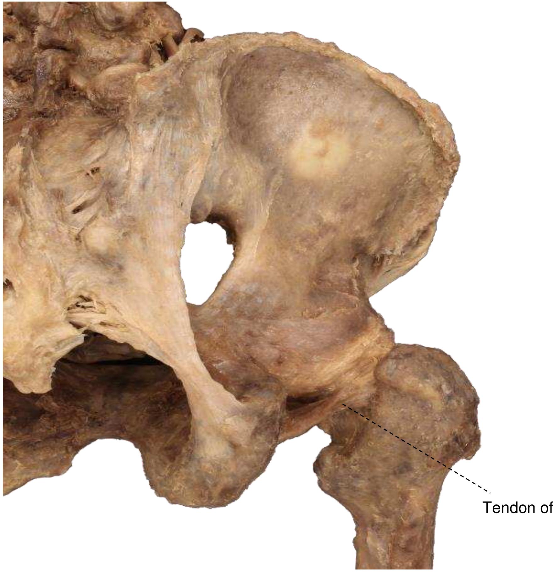 Posterior view of the pelvis, right side, with all
