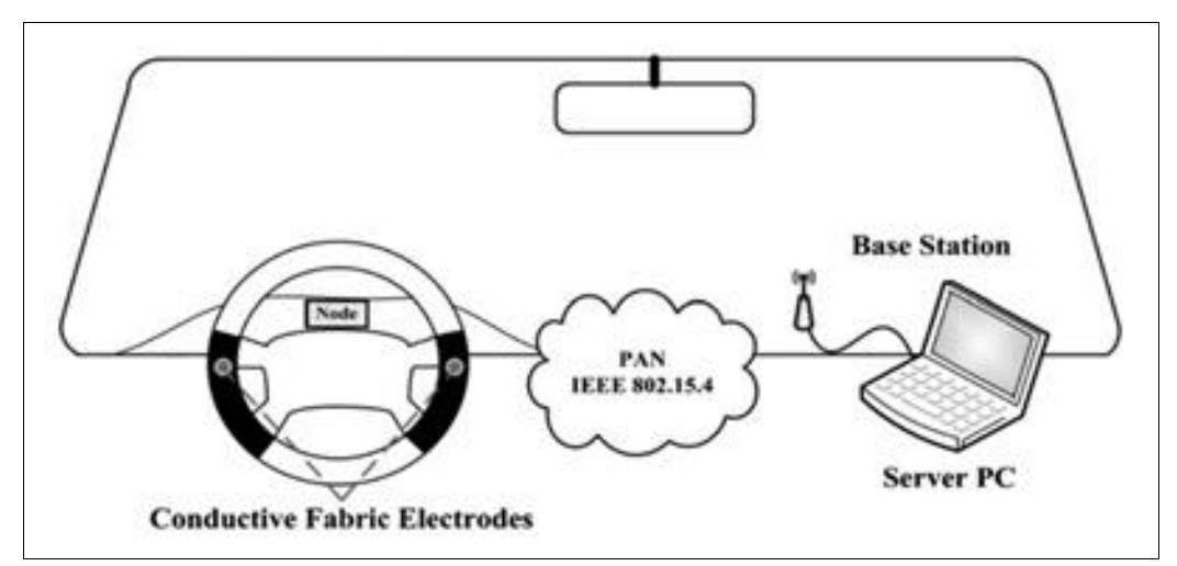 Ecg system architecture [50].