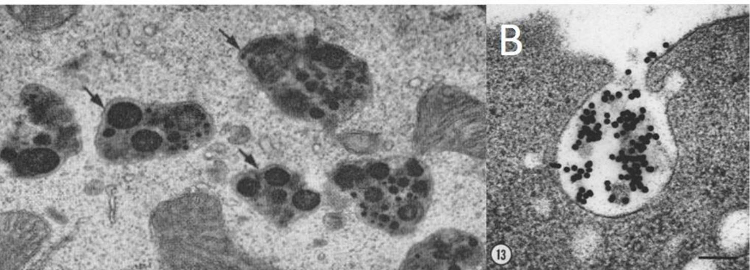 A: cross-section of an excretory tube cell of the