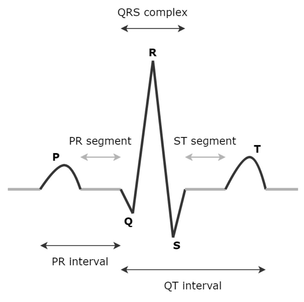 1: the usual structure of an ecg signal. ii are used because