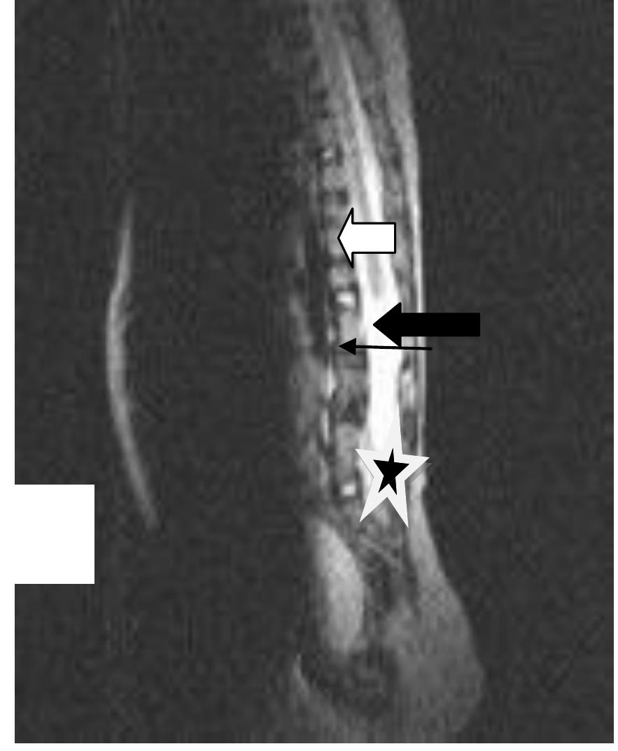 T2- weighted mr image sagittal view of the thoracic and
