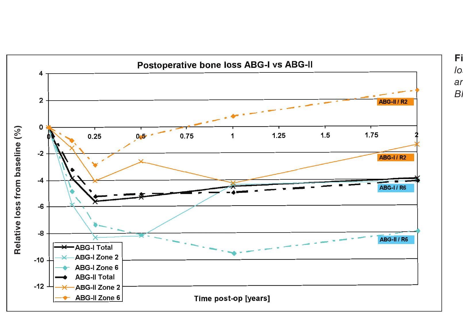 In the distal gruen zones 3, 4 and 5, comparing bone loss