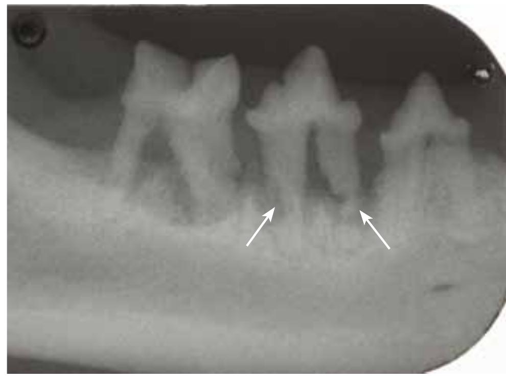 This radiograph shows horizontal and vertical alveolar bone