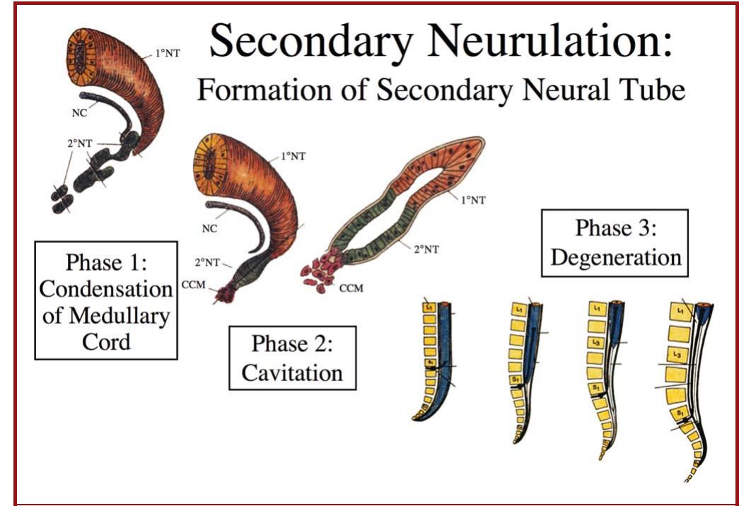 Schematic drawings to show the 3 phases of secondary