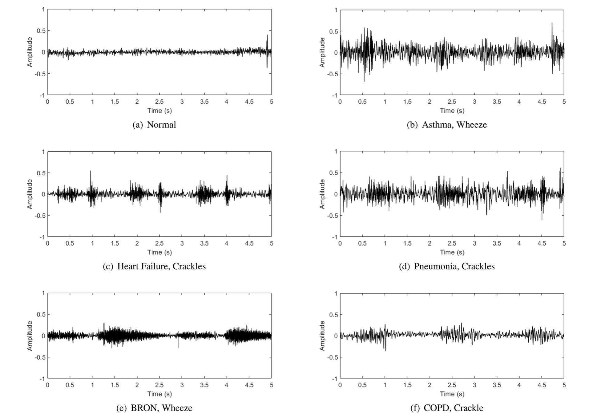 - examples of lung sound signals with adventitious wheezes