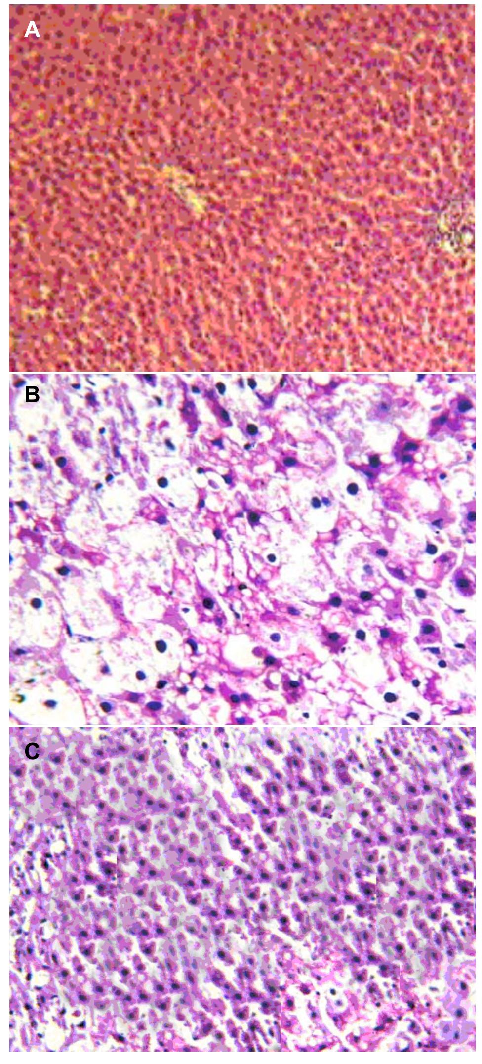 Photomicrographs of the liver tissue of control group (a)