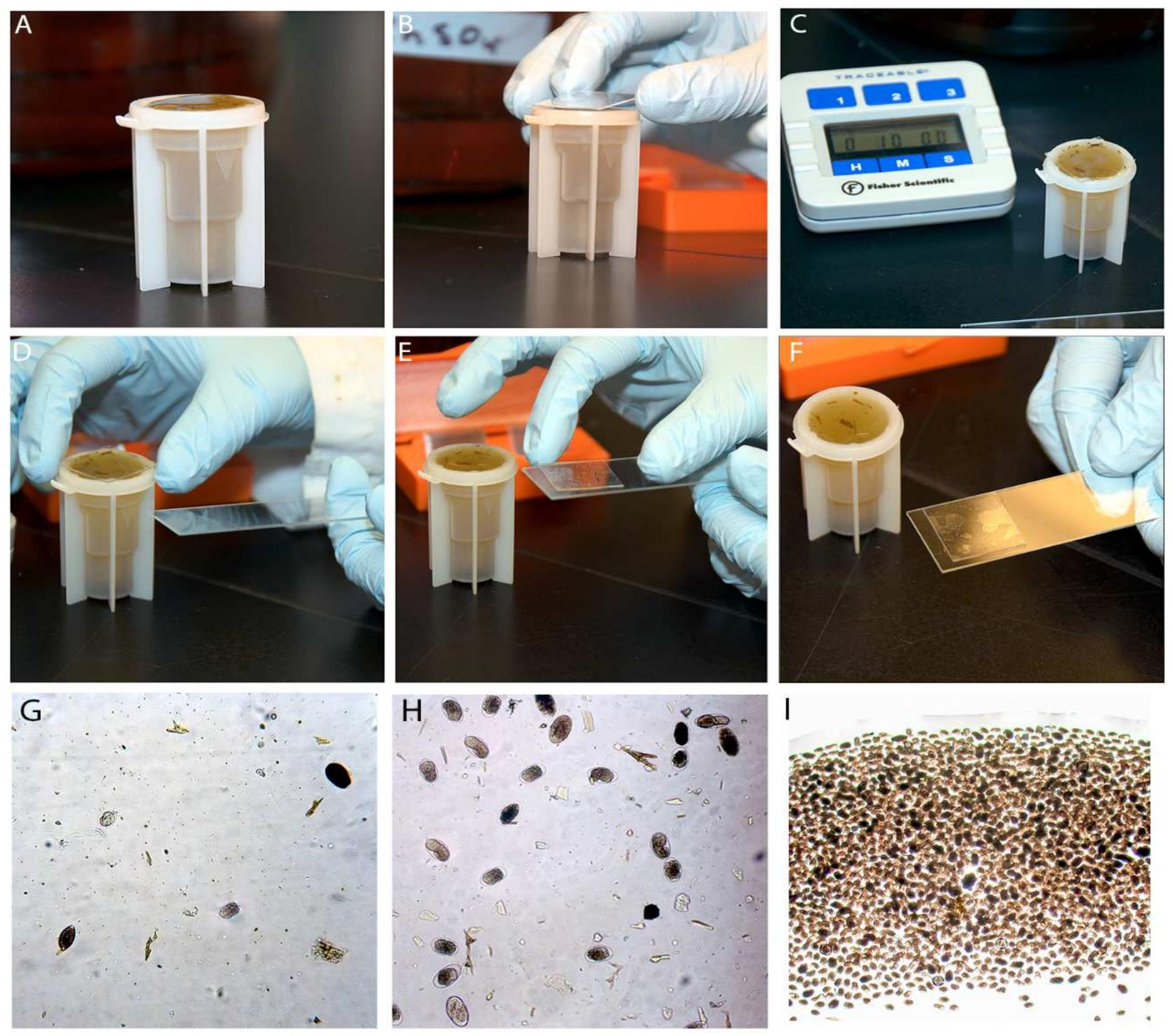 Fecal float. a) feces and floatation solution mixture in