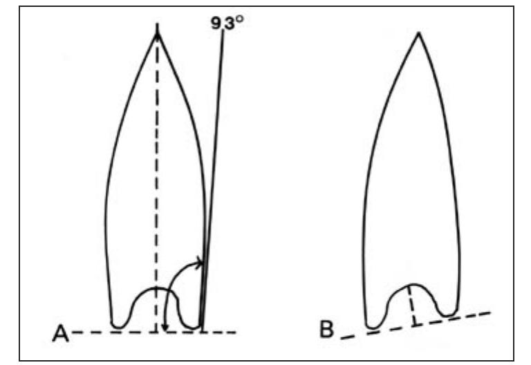 Measurement of face-angle (a) and basal concavity depth (b).