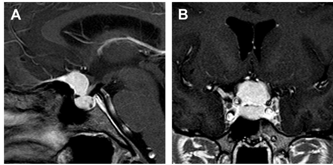 Wide range of pathology along the anterior cranial fossa