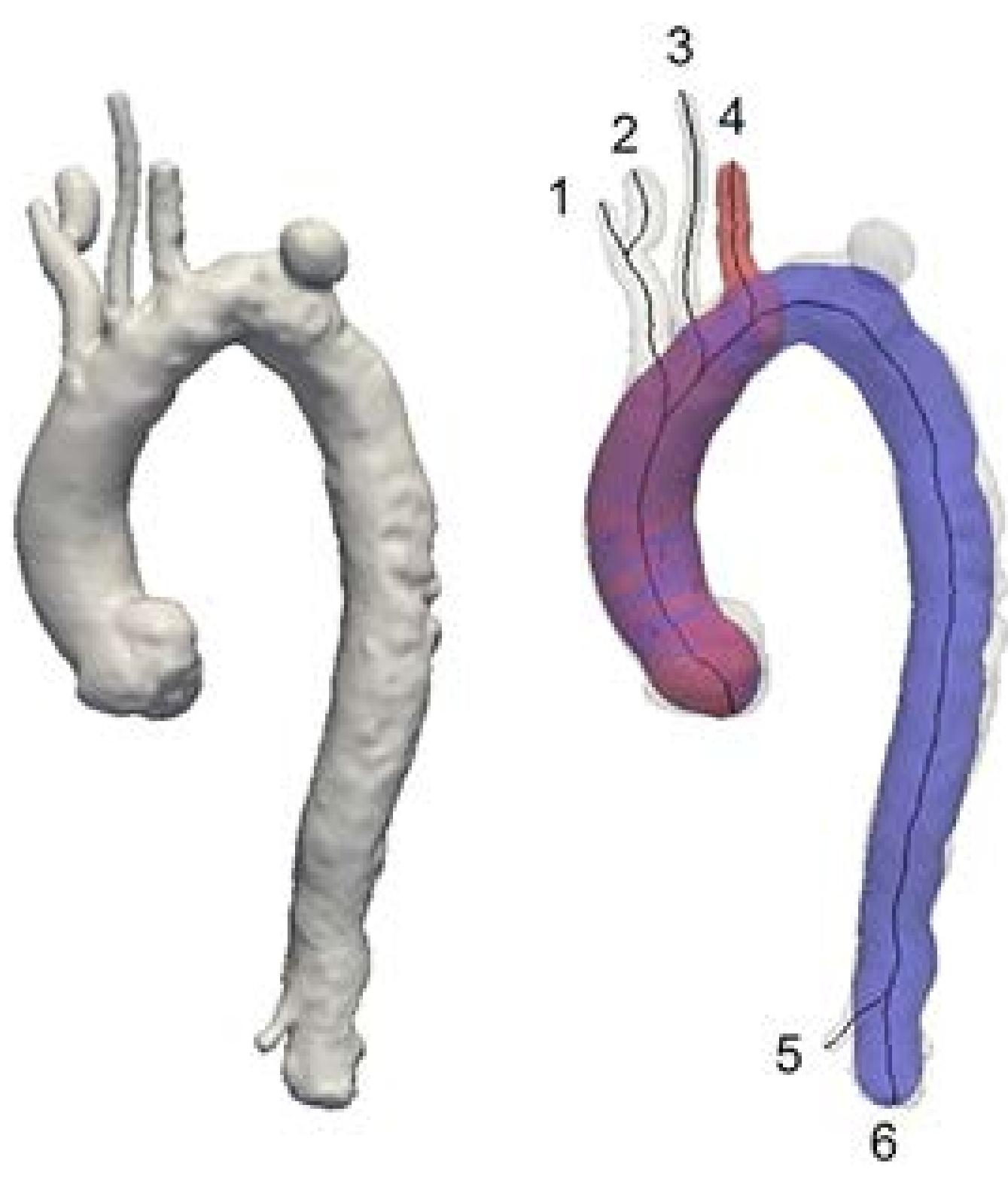 3: left: realistic surface model of the thoracic aorta.