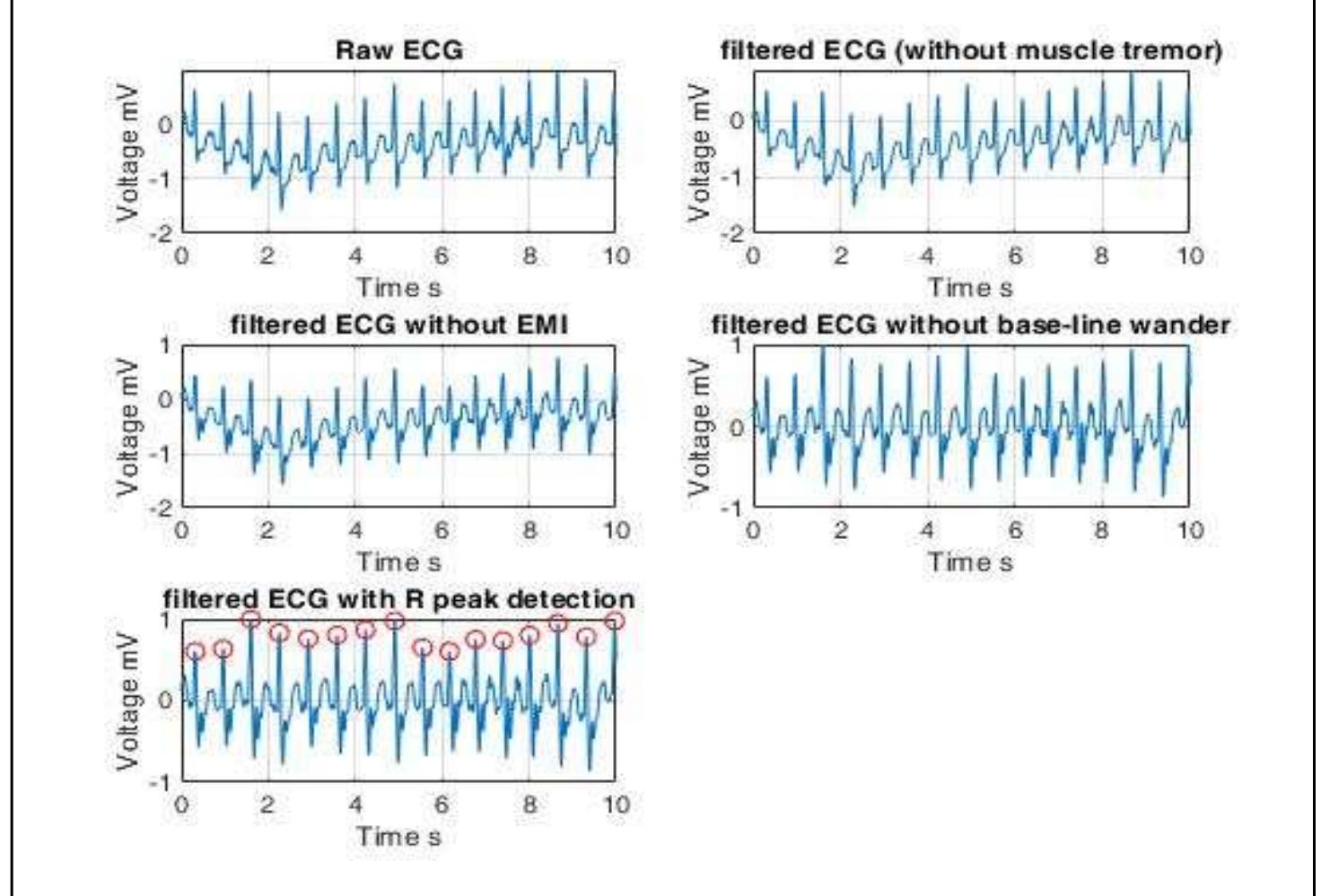 Ecg signal pre-processing (left to right): ecg signals are