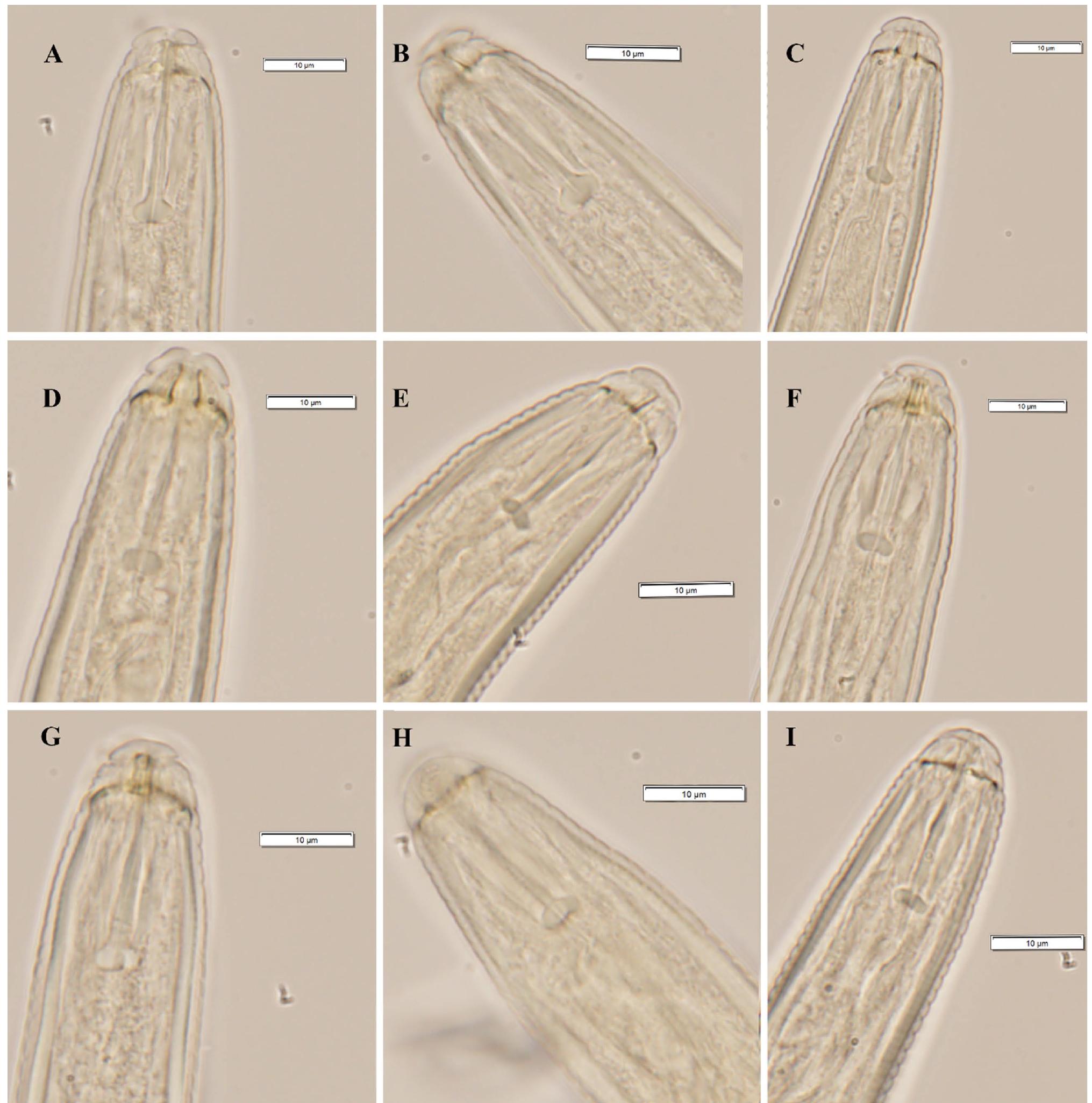 Second-stage juvenile (n= 173). body shape vermiform,