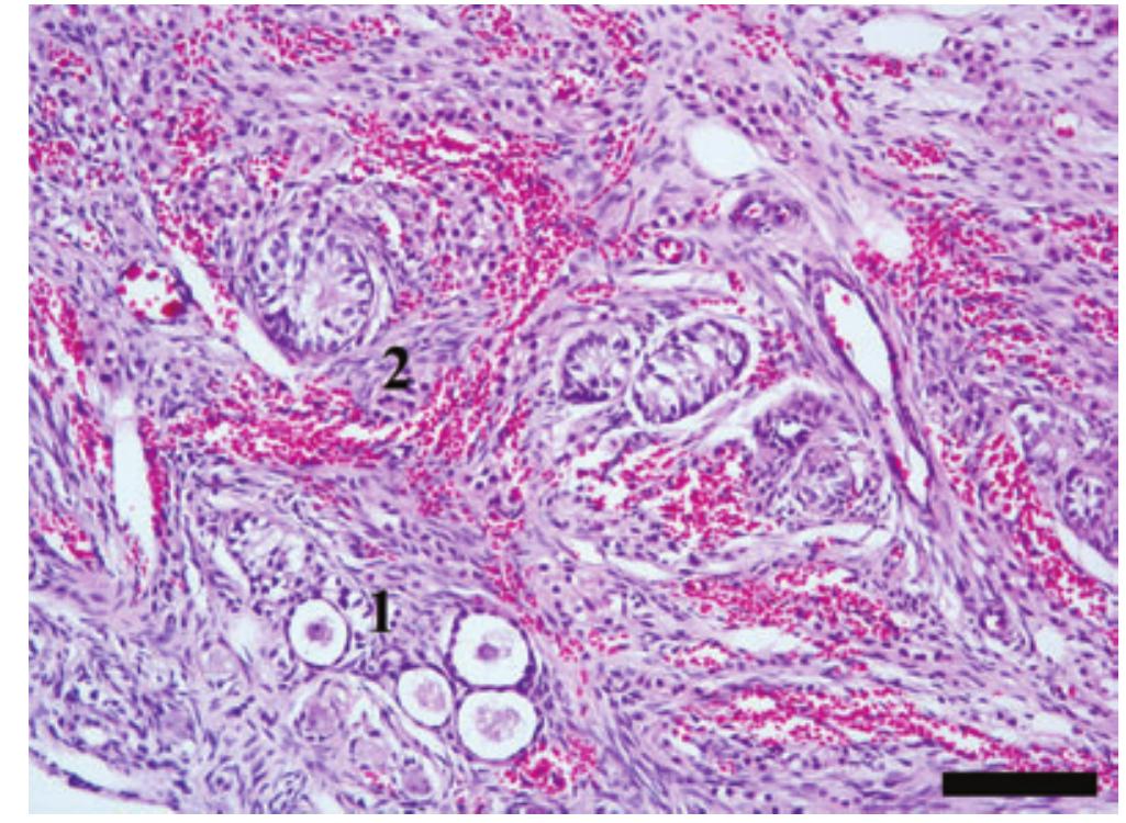 Ovotestis. gonadal cortex and superficial medulla showing:
