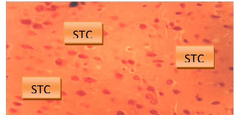 Plate 6: a transverse section of cerebral cortex of group 6,