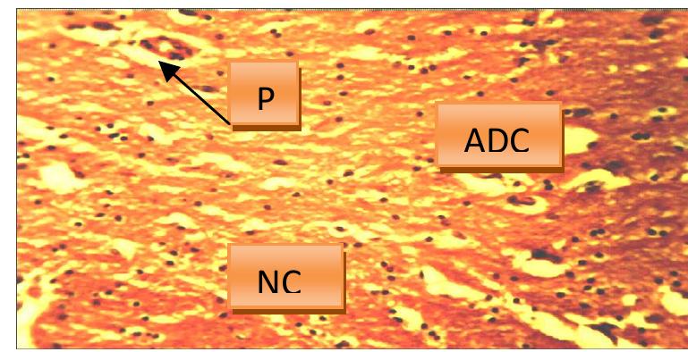 Plate 2: a transverse section of cerebral cortex of the