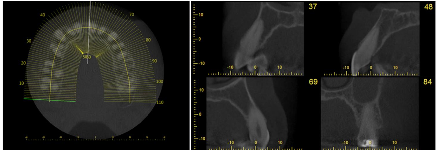 Left: position of cross-sectional images, perpendicular to